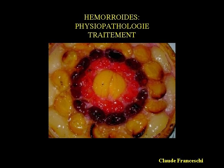HEMORROIDES PHYSIOPATHOLOGIE TRAITEMENT Claude Franceschi PREMIER ...