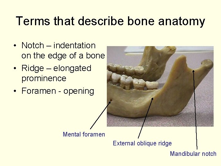 BONES And Their Radiographic Appearance 22 Bones make