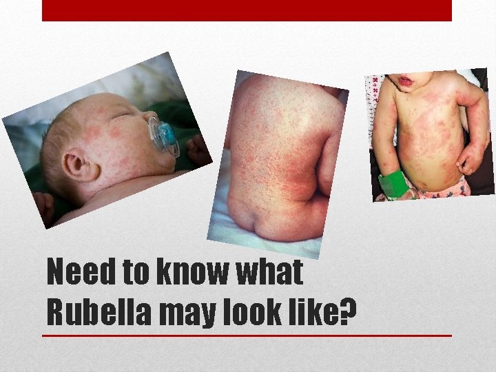 Rubella Anatomy Paige Hopper What is this Infection