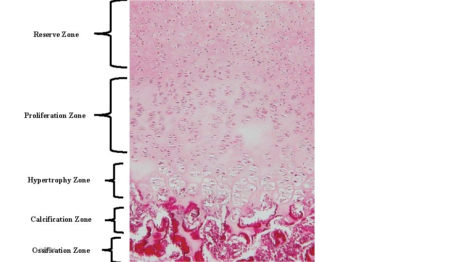 Bone Part 2 Dr Mohammed Hussein 1 36