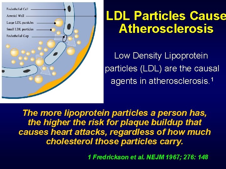 LDL Particles Cause Atherosclerosis Low Density Lipoprotein particles