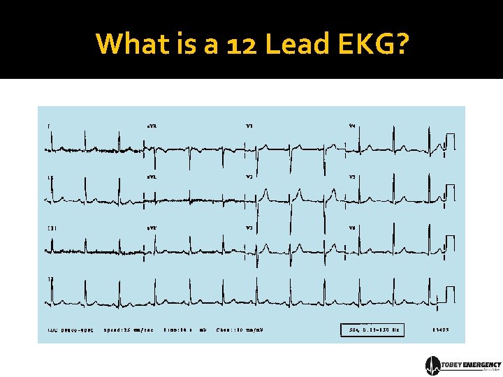 Almost Everything You Wanted To Know About ECGs