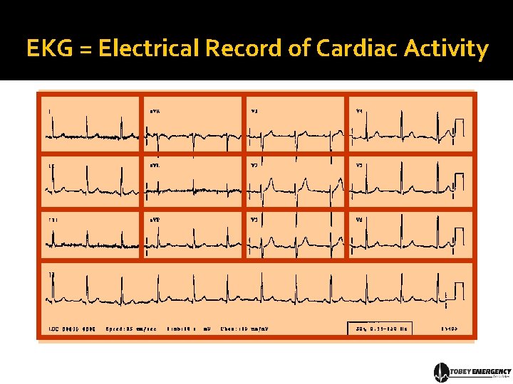 Almost Everything You Wanted To Know About ECGs