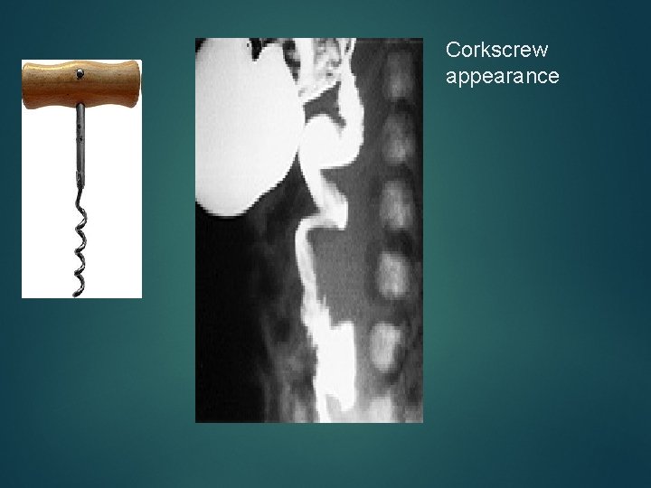 GASTROINTESTINAL ANOMALY IN PAEDIATRIC presented by Dr ALIYA