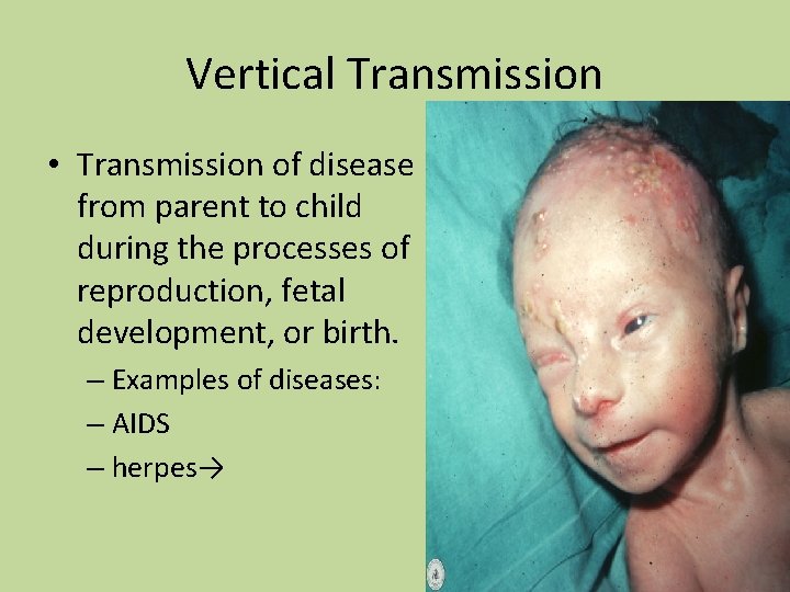 Occurrence of infectious diseases Biomedical Technology Part two