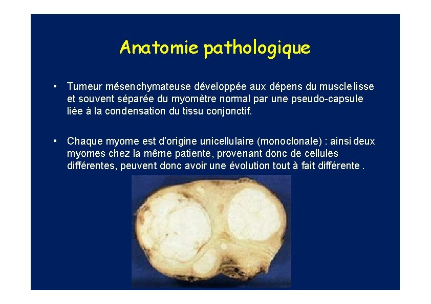 MYOMES UTERINS Present par Dr BICHA Introduction Tumeur