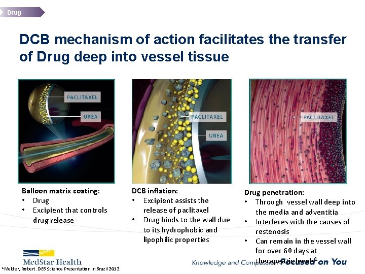 Conquering RestenosisUse of DCB and Other Future Therapies