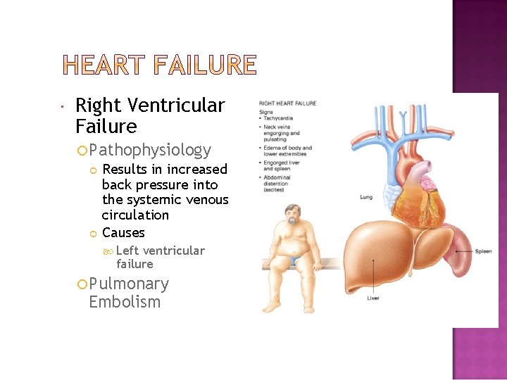 Left Ventricular Failure Pathophysiology Results in increased back