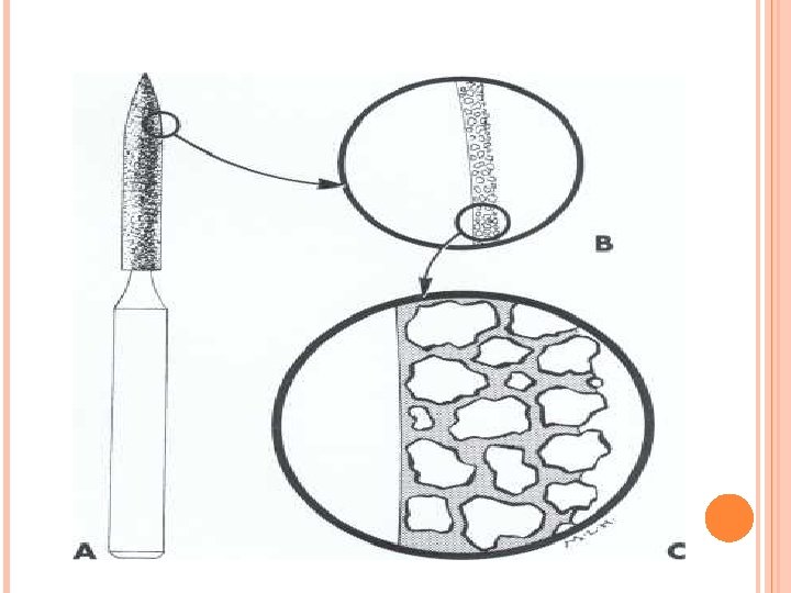 DENTAL BURS OTHER MODALITIES OF TOOTH PREPARATION DENTAL