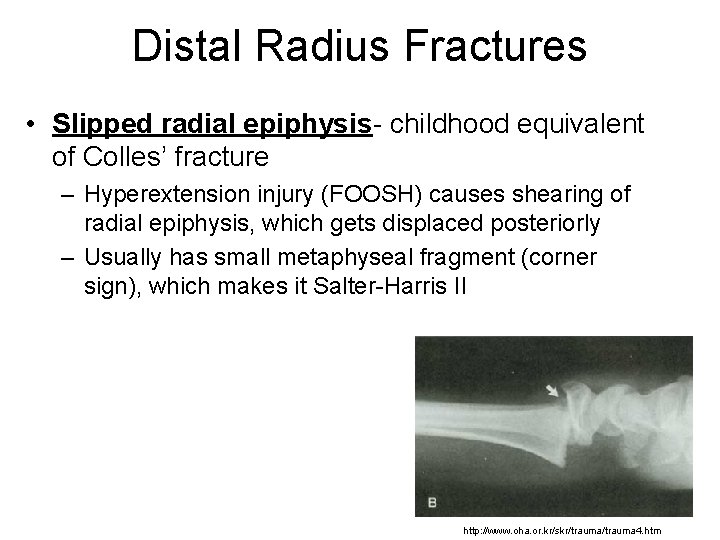 Wrist Trauma Fractures and Dislocations of the Wrist