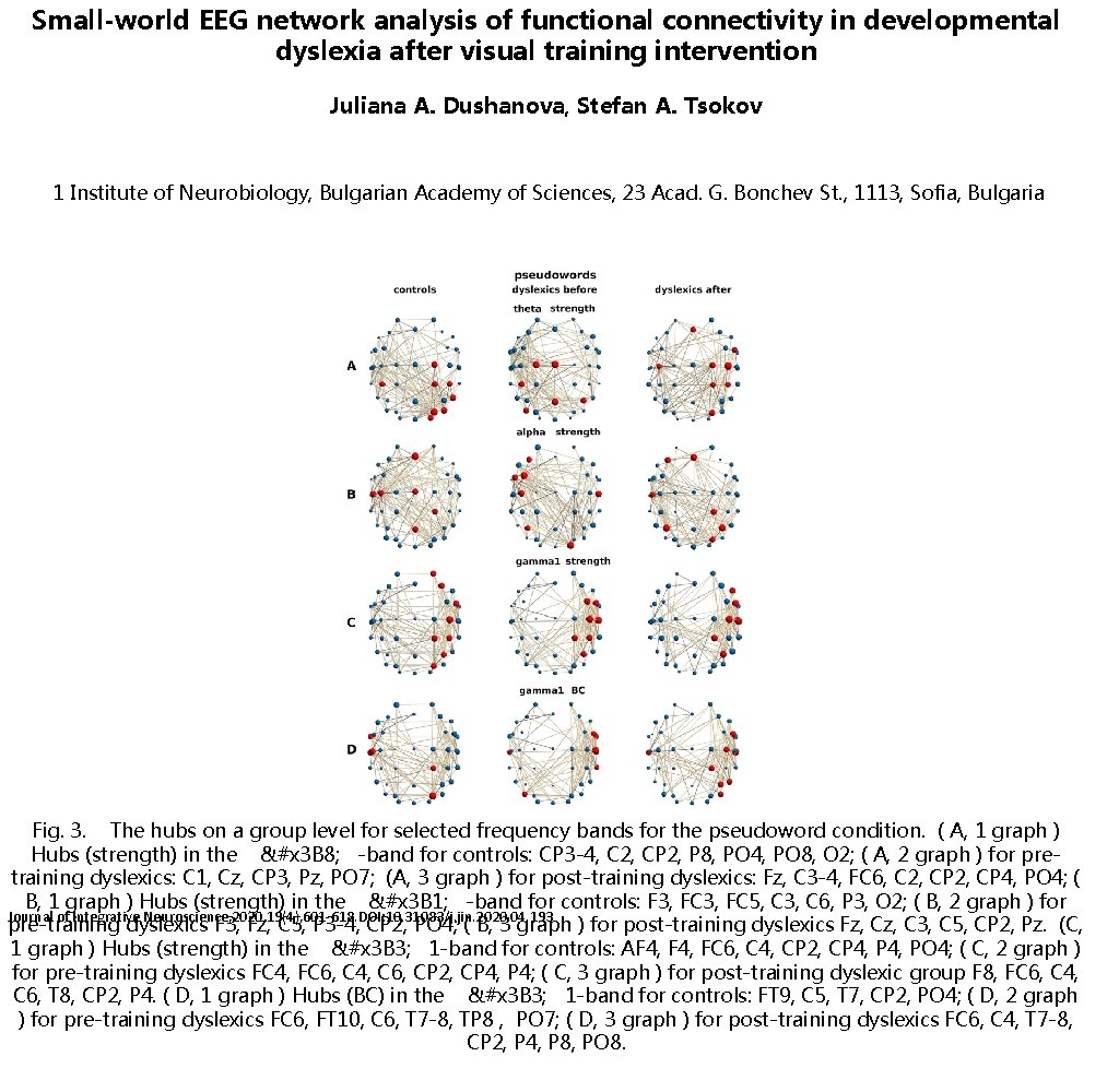 Smallworld EEG network analysis of functional connectivity in