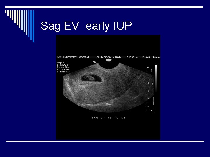 ULTRASOUND PEARLS 609 Uls GB nl Ultrasound discovered