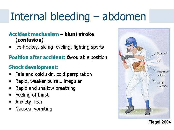 First Aid Bleeding Internal Mgr Zdeka Kubkov Bc