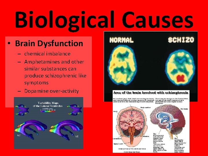 Schizophrenia Alexa Cornwall Allie Warren Kate Auty Elizabeth