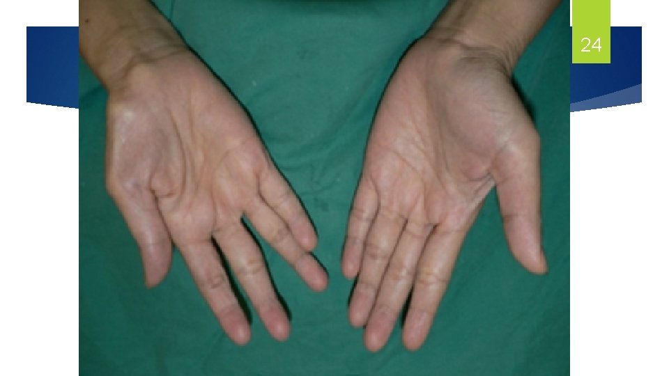 1 Hand examination 2 Finger joints 3 Hand