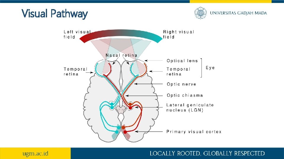 REFLEKSI KASUS STROKE LOBUS OCCIPITAL Hemianopsia Homonim I