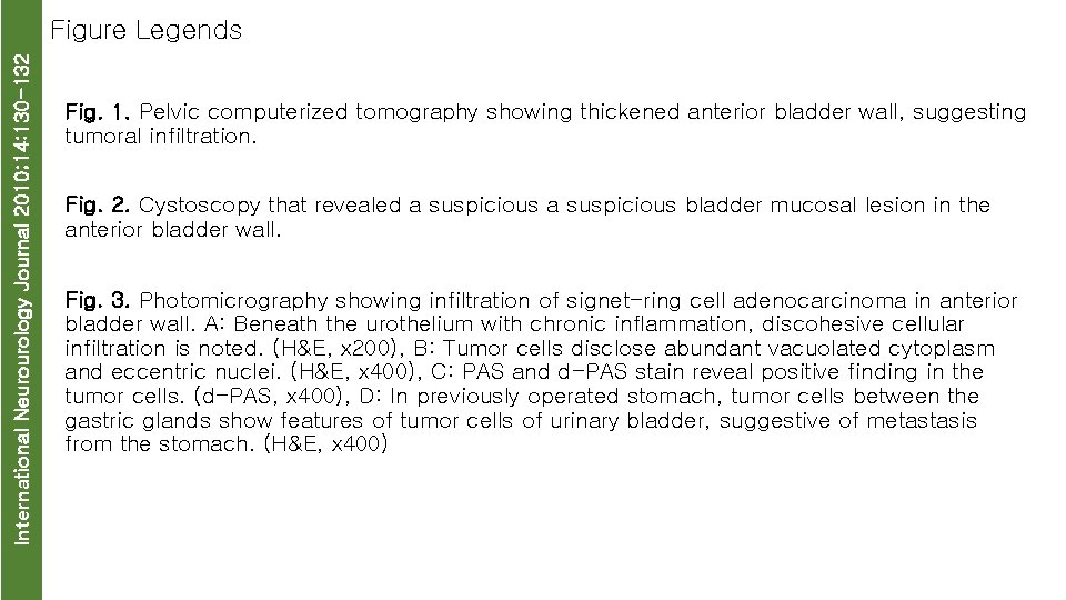 International Neurourology Journal 2010 14 130 132 A