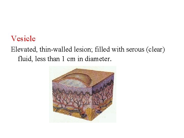 ULCERATIVE LESIONS OF THE ORAL CAVITY Macule flat