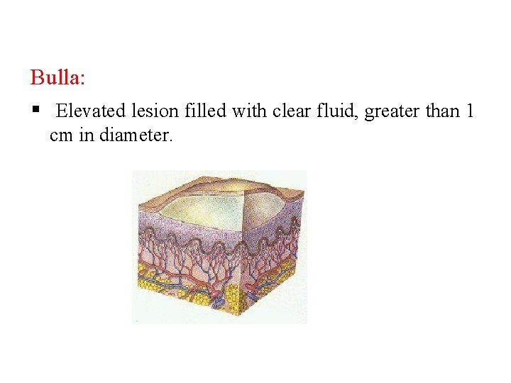 ULCERATIVE LESIONS OF THE ORAL CAVITY Macule flat