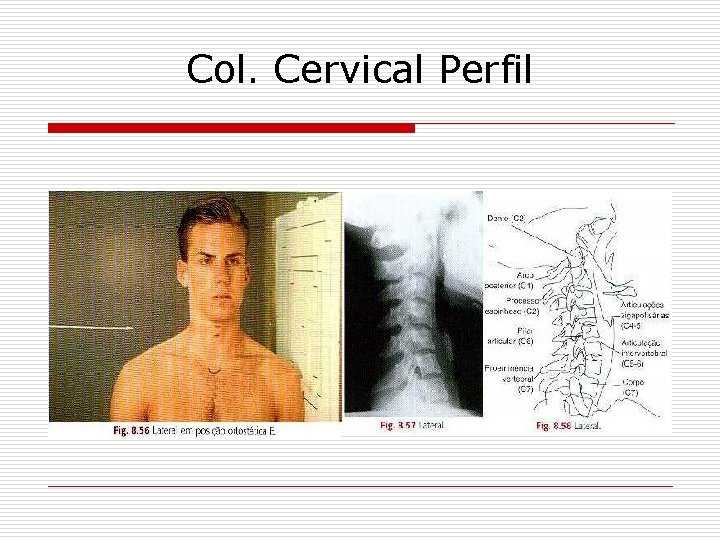 POSICIONAMENTO RADIOLGICO Tcnicas Bsicas Radiologia Convencional ...