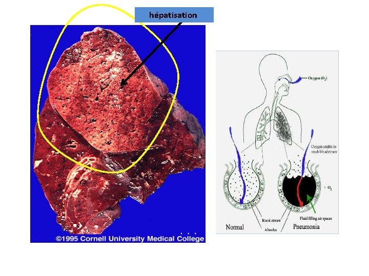 Facult de mdecine dAnnaba 04me anne mdecine Cours