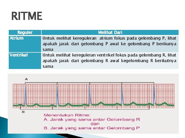 DASARDASAR EKG Oleh H Asep Solihat Definisi Elektrokardiografi