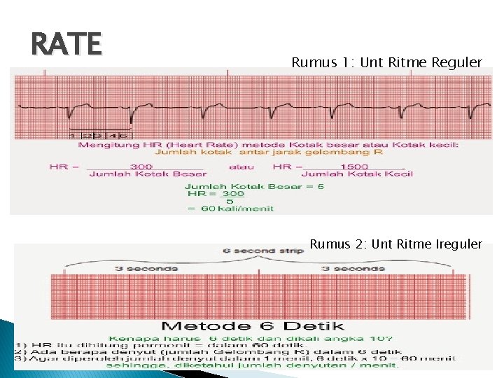 DASARDASAR EKG Oleh H Asep Solihat Definisi Elektrokardiografi