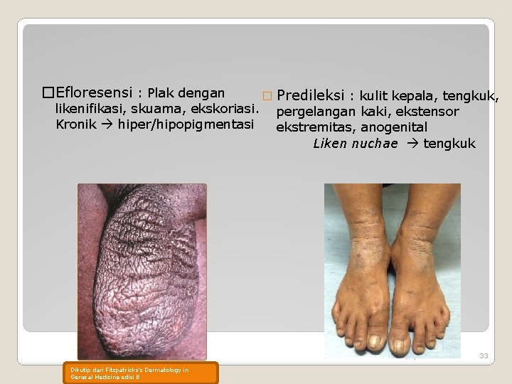 Dermatitis penatalaksanaan keperawatan dalam konsep keluarga Ns Chandra
