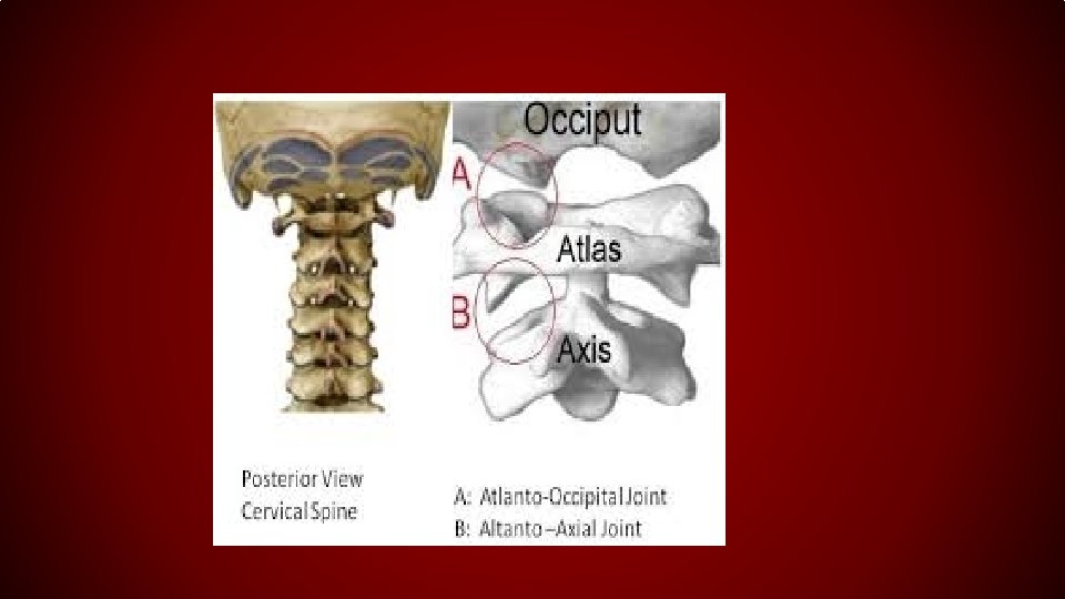 JOINTS OF NECK Prepared By Dr Sadaf Aziz