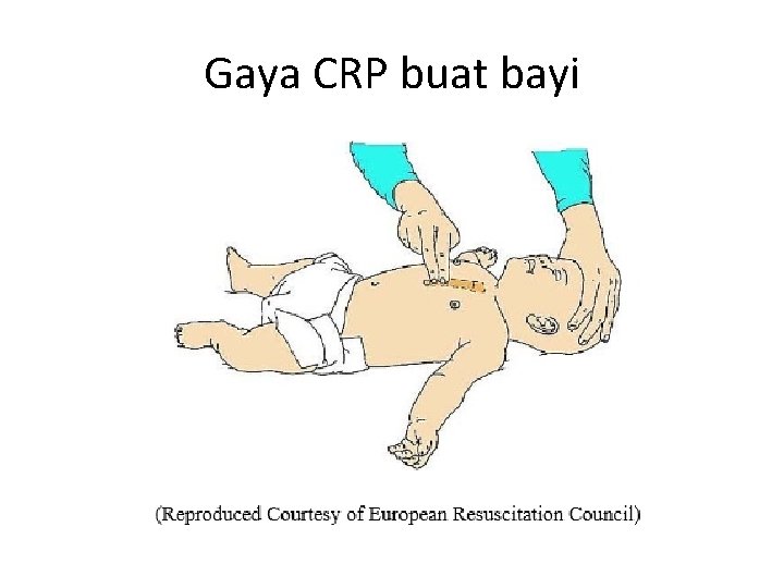 Basic Emergency Management Material from resus org au