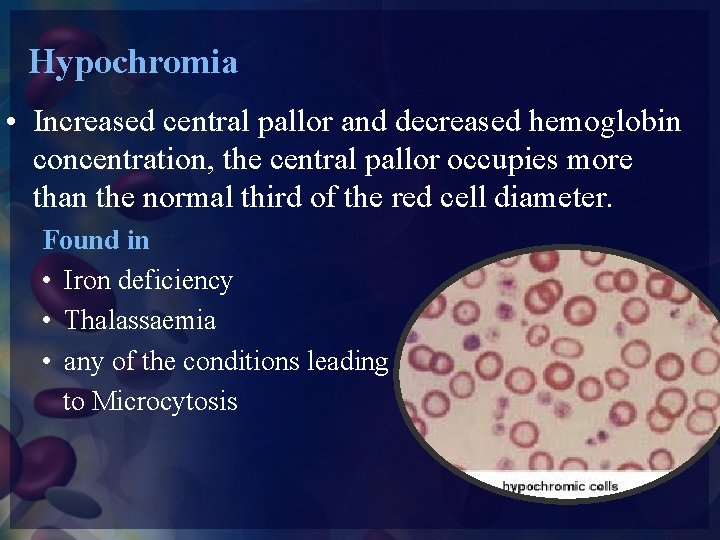Practical Hematology Lab LAB 2 RBCs Morphology RBCS