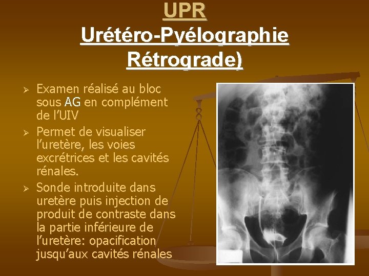 UROLOGIENEPHROLOGIE EXAMENS COMPLEMENTAIRES EXAMENS RADIOLOGIQUES AUSP ...