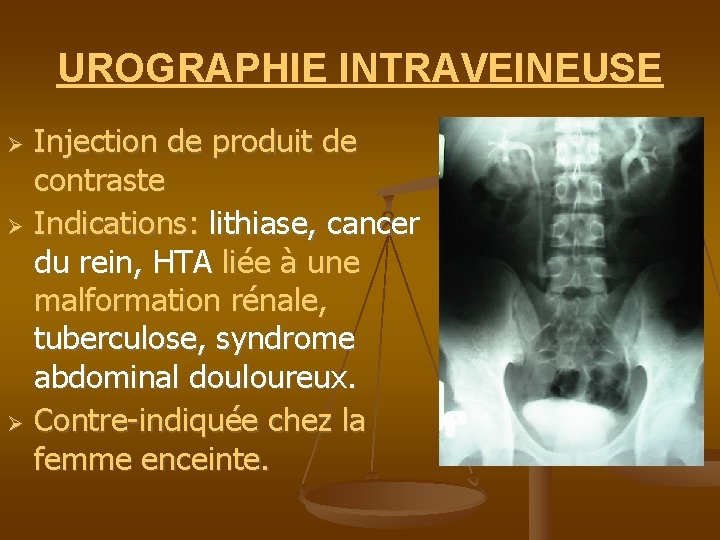 UROLOGIENEPHROLOGIE EXAMENS COMPLEMENTAIRES EXAMENS RADIOLOGIQUES AUSP ...