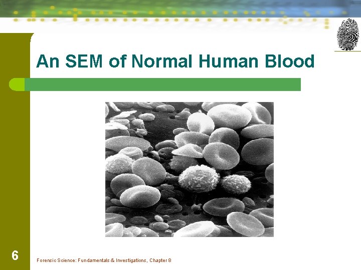 Chapter 8 Blood and Spatter 194 211 l