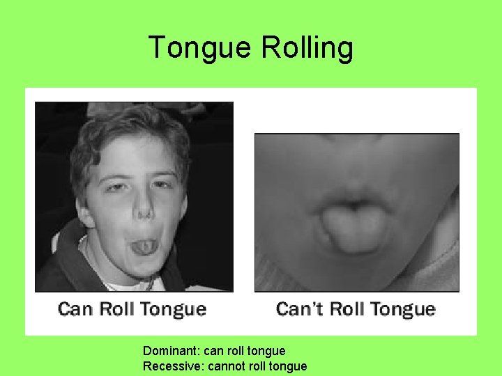 An Inventory of My Traits Human Genetics Earlobes