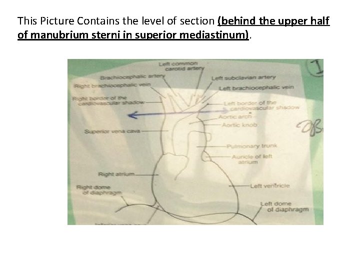 Lab CT scan Murad Kharabsheh Yaman Alali Some