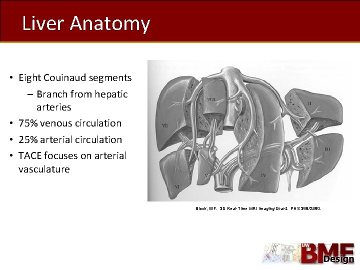 MRI Liver Phantom for Transarterial Chemoembolization Simulation Team