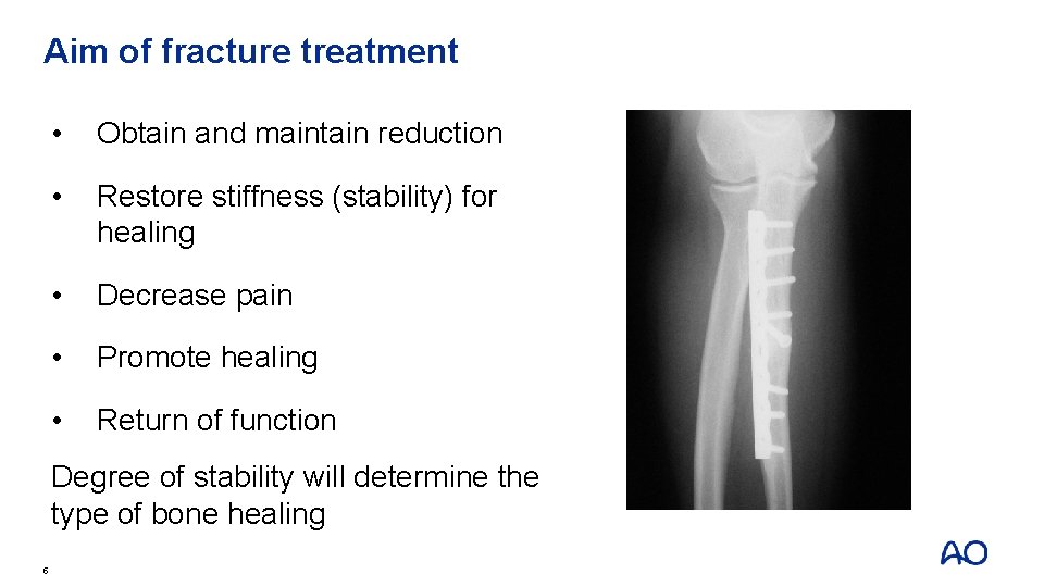 Absolute stability biomechanics techniques and fracture healing AO