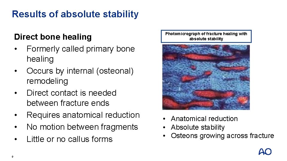 Absolute stability biomechanics techniques and fracture healing AO