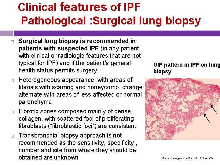 IDIOPATHIC PULMONARY FIBROSIS CLINICAL FEATURES AND DIAGNOSIS OF