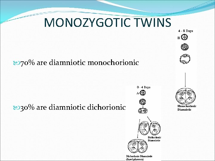 Lecture 14 MULTIPLE PREGNANCY THE UTERINE RUPTURE Prof