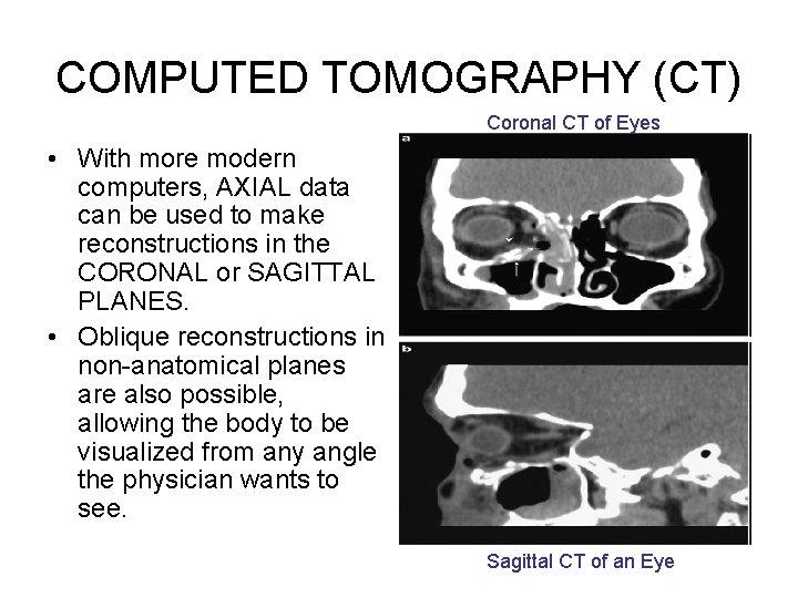 MEDICAL IMAGING OF THE VERTEBRAE Vertebrae are your