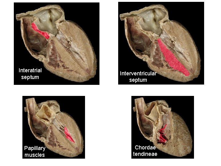 Histology Formed Elements Erythrocyte red blood cell Thrombocytes