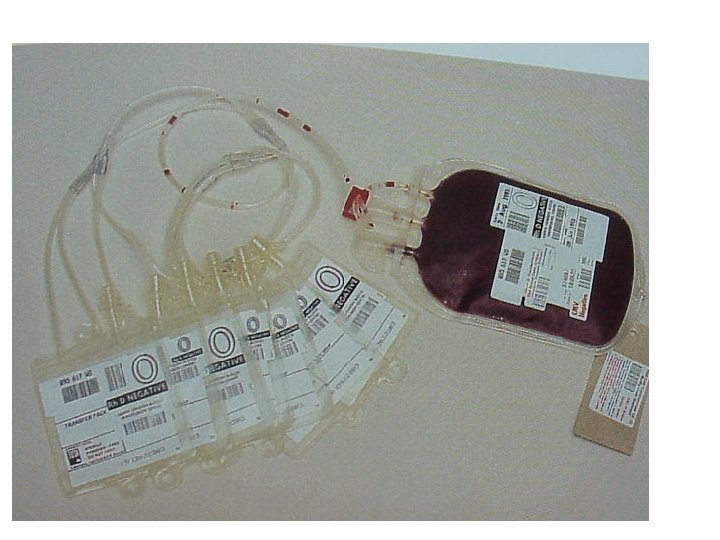 Les produits sanguins labiles Dr BOULKADID DEFINITION Ils