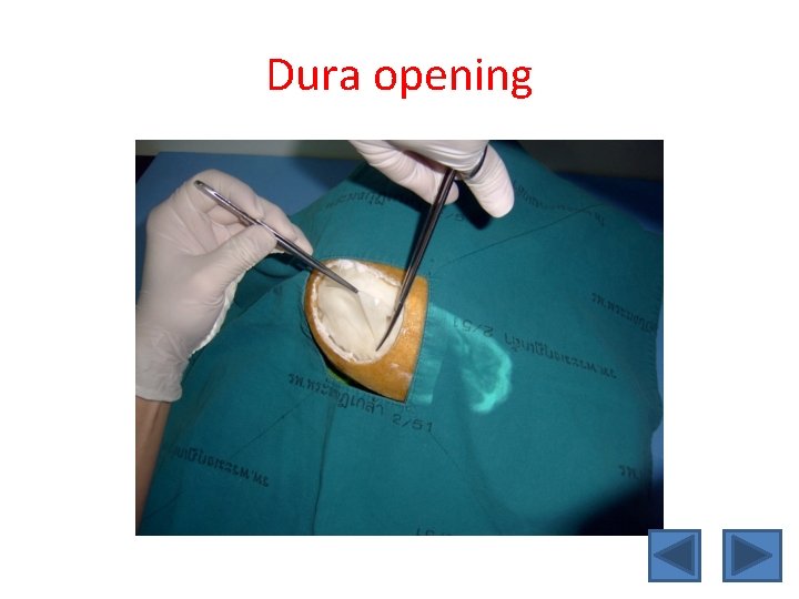CAI Neurosurgical Operation Virtual Simulation Brain abscess resection