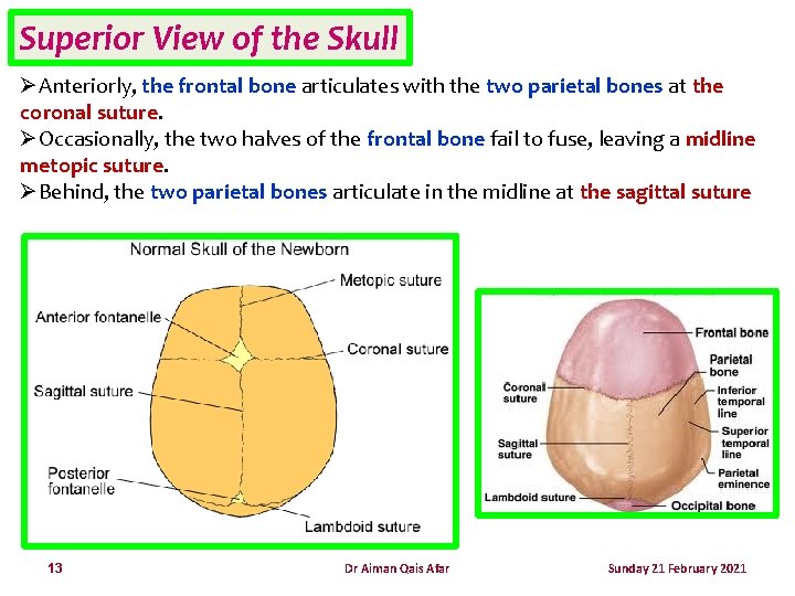 MUSCULOSKELETAL SYSTEM THE SKULL Dr Aiman Q Afar