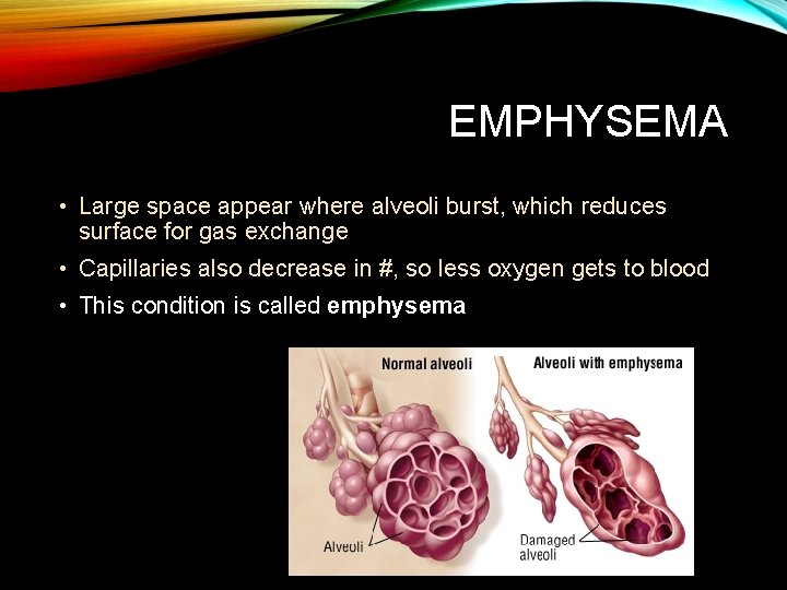 CHAPTER 8 Smoking SMOKING Considered disease by Word
