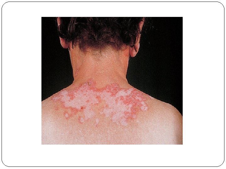 CONNECTIVE TISSUE DISEASES Dr Rzan Objectives 1 define