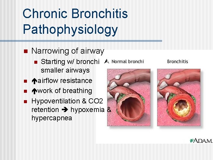 Obstructive and Inflammatory Lung Disease DR ISAZAEHFAR Obstructive