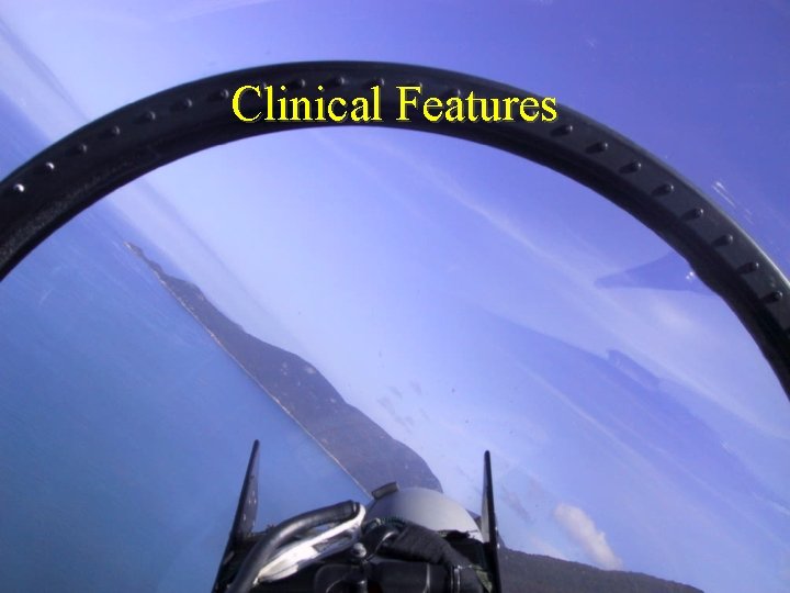 Diverticular Disease Richard Rahdon Objectives Definition Pathology ...